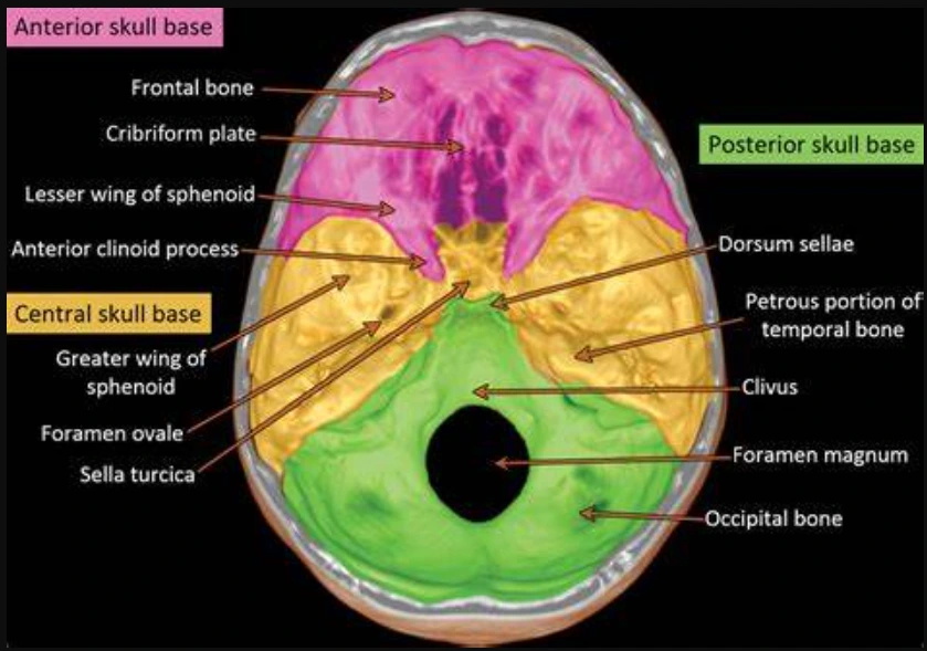 Central Skull Base Osteomyelitis: Overview, Causes, and Management ...