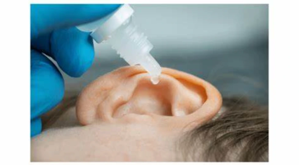 Fungal Infections of the Ear (Otomycosis): Causes, Symptoms, and ...